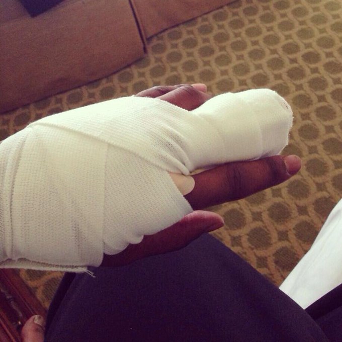 Horrific injuries of National football league players (part 1) - Your ...